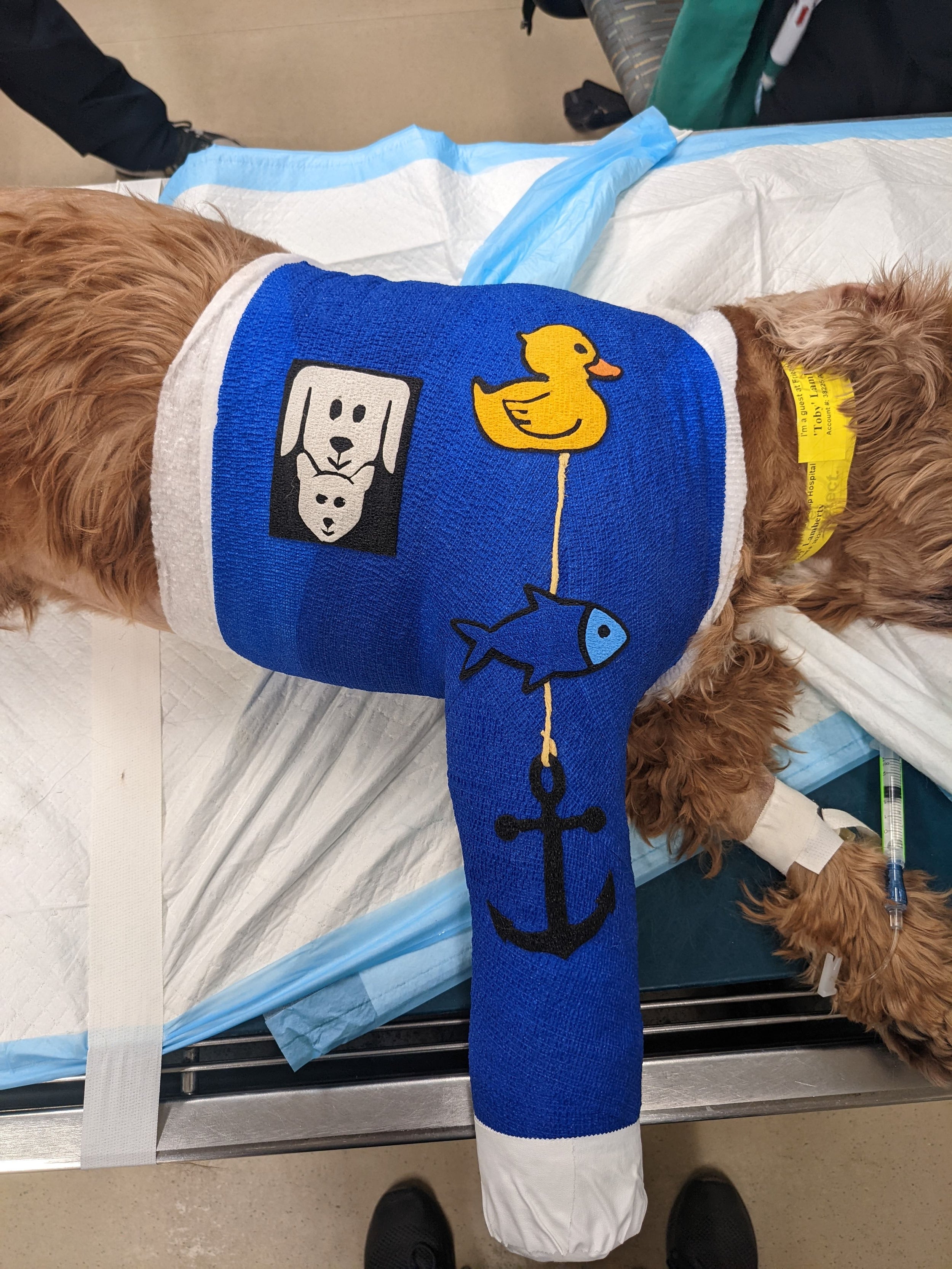 SPICA Splint – Brian's Bandages